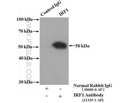 IRF1 antibody (11335-1-AP) | Proteintech