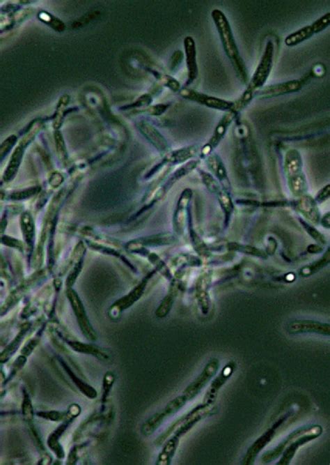 Free Picture Bacillus Anthracis Spores Phase Contrast Microscopy
