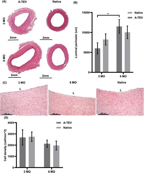 Expression Of Endothelial And Smooth Muscle Markers And Cell
