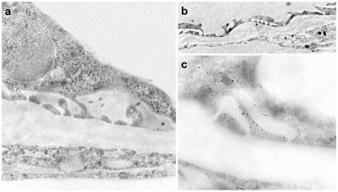 Podocyte Ultrastructure Is Preserved In Glomeruli Transplanted Into The
