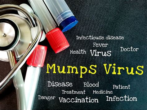 6 Tips To Prevent Mumps From Spreading