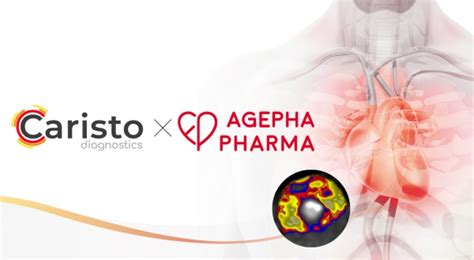 Cardio Diagnostics And Agepha Pharma Partner For Chd Study Using Lodoco®
