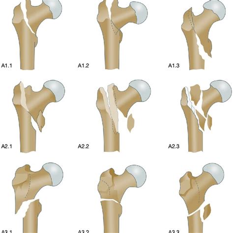 Postoperative And Follow Up Imaging A B X Rays Images 1 Month After