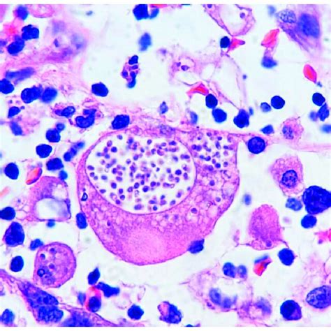 Phylogenetic Tree Generated Using The Mega 11 Software Constructed Download Scientific Diagram
