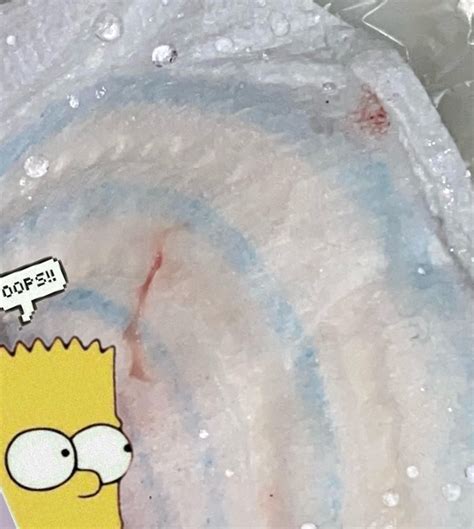 Is This A Pinwormthreadworm I Found This On My Menstrual Blood Its