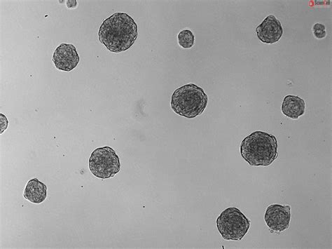 All Inclusive 3d Human Chondrocyte Articular Spheroid Formation Kit
