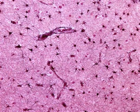 Astrocytes Light Micrograph Stock Image C048 3026 Science Photo Library