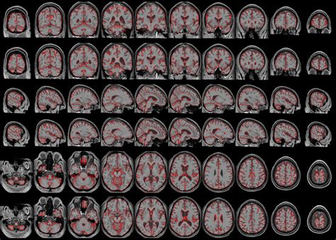 Re Evaluate QC Images Issue 7 CoBrALab IterativeN3 GitHub