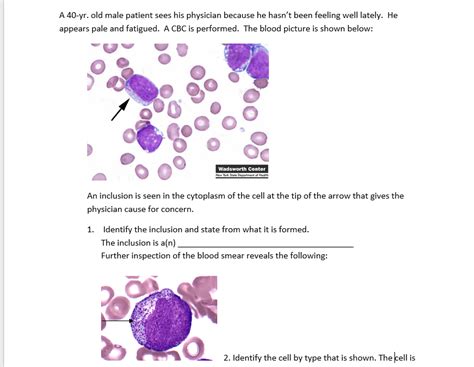 Solved A 40 Yr Old Male Patient Sees His Physician Because