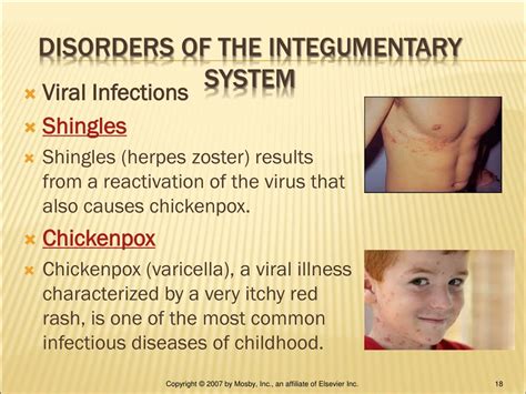 Diseases Of The Skin List