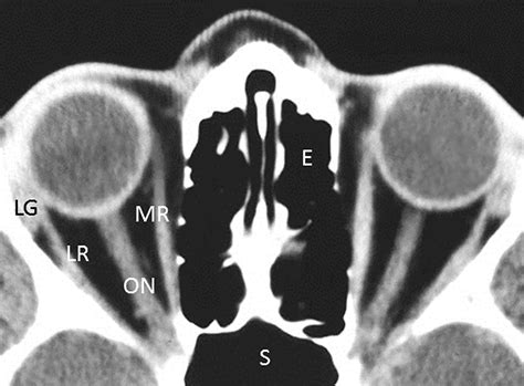 Orbital Imaging Clinical Tree