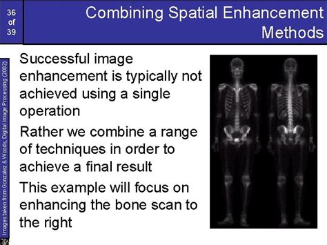 Digital Image Processing Image Enhancement Spatial Filtering 2