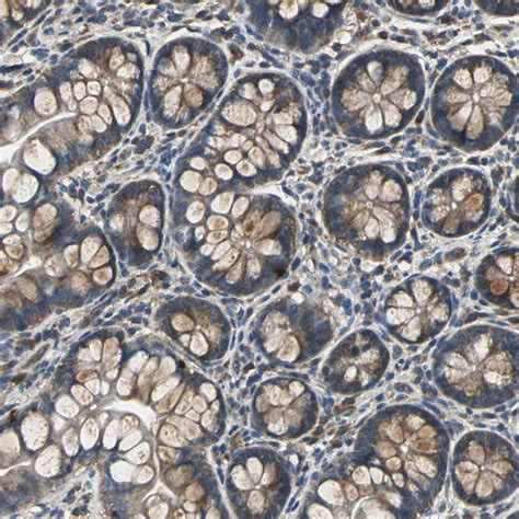 Rabbit Polyclonal Anti Irf3 Antibody Buy For Research Highly