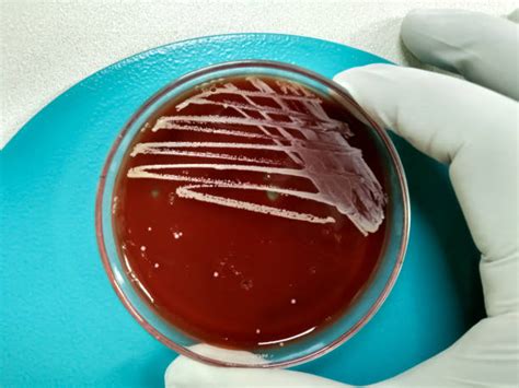 40 Enterococcus Faecium Photos Photos Taleaux Et Images Libre De
