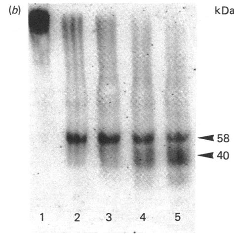 Sdspolyacrylamide Gel Electrophoresis And Western Blot Of Ml Antigen