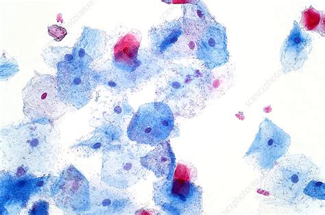 Buccal Mucosa Cell Light Micrograph Stock Image F0341789