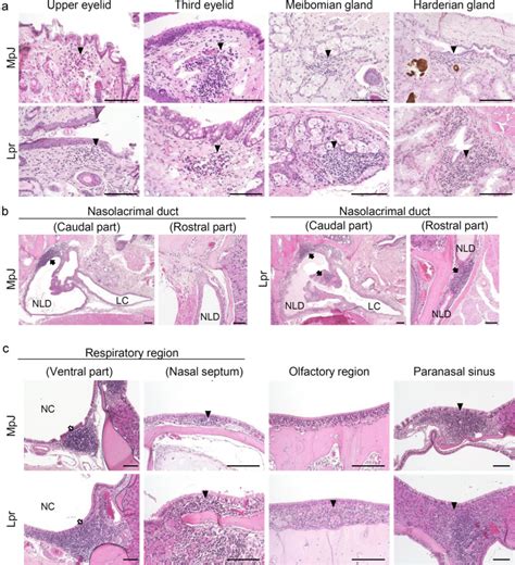 Altered Morphology Of Mucosa Associated Lymphoid Tissues And Epithelium In The Nasal Cavity And