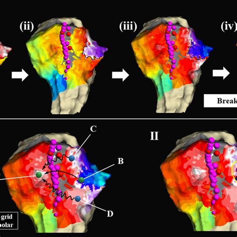 Activation And Voltage Maps During Afl After The Cti Linear Ablation