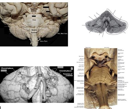 Neurology Wet Lab Practical Diagrams 3 Diagram Quizlet