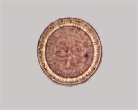 Echinococcus Granulosus Egg