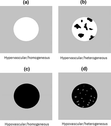 Illustration Of Vascular And Enhancement Patterns A Download