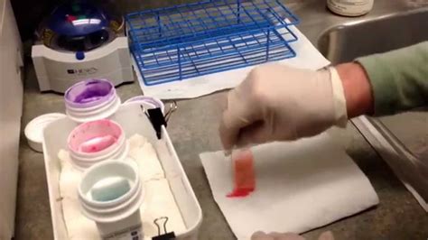 How To Prepare A Slide For A Cytology Evaluation YouTube