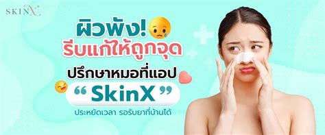 สิวเป็นไต Nodular Acne เกิดจากอะไร รักษาด้วยวิธีไหนได้บ้าง Skinx