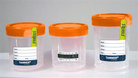 Streamlining Lab Efficiency With Quality Specimen Cups