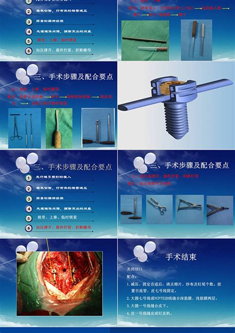 胸椎前路手术配合ppt 卡卡办公