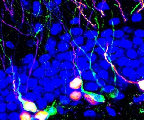 Stimulating Brain Circuits Promotes Neuron Growth In Adulthood