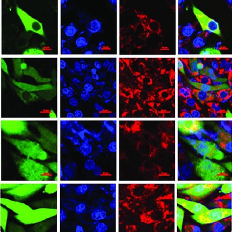 The Identification Expression Subcellular Localization Of