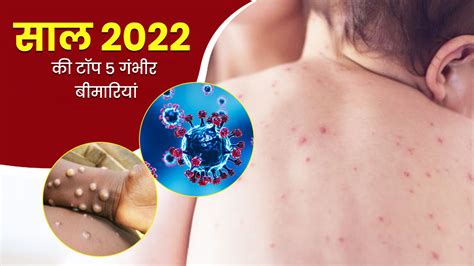 साल 2022 की टॉप 5 गंभीर बीमारियां Top 5 Deadly Diseases In The World