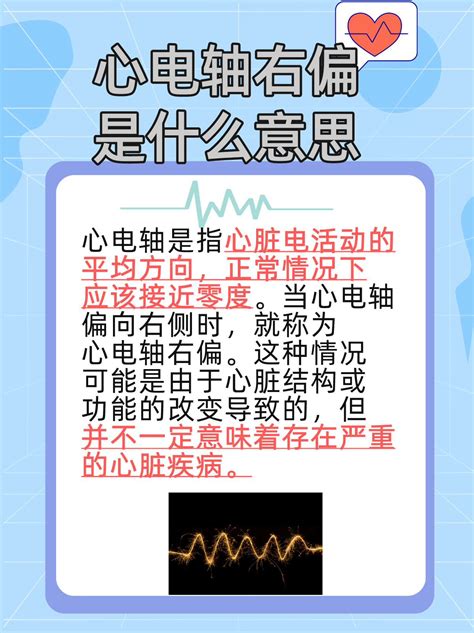 心电轴右偏不是大问题但别忽视它 家庭医生在线家庭医生在线首页频道
