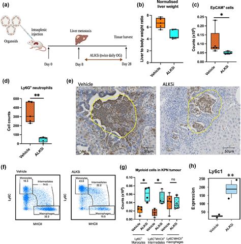 Figure 2 From Co Inhibition Of Tgf β And Pd L1 Pathways In A Metastatic