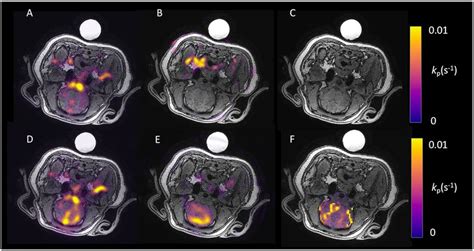 hyperpolarised 13 c imaging in the porcine brain a c example summed
