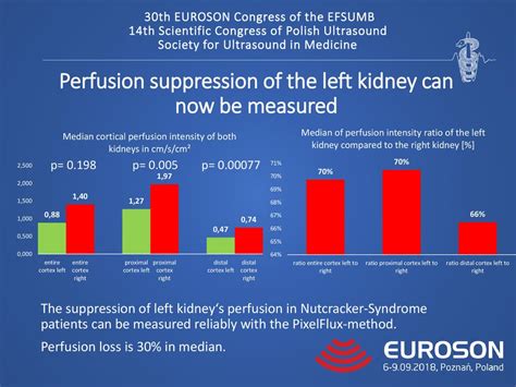 Renal Parenchymal Perfusion Measurement With The PixelFlux Method To