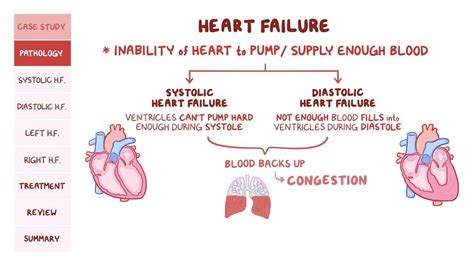 Video Heart Failure Pathology Review Osmosis