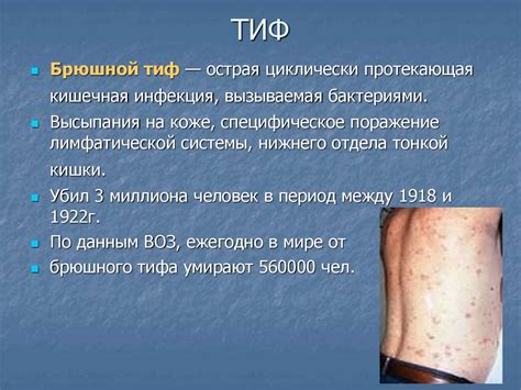 Инфекционные болезни - презентация онлайн