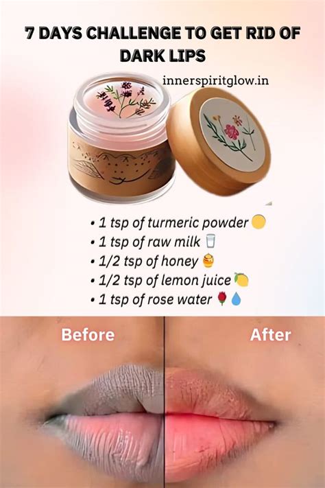 7 Days Challenge To Get Rid Dark Lips Get Rid Dark Lips Lip Care