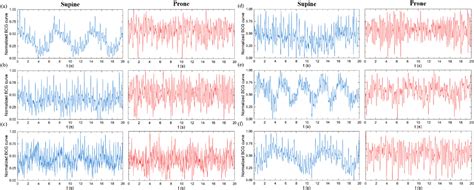 Figure 6 From Bed Based Ballistocardiography System Using Flexible Rfid Sensors For Noninvasive