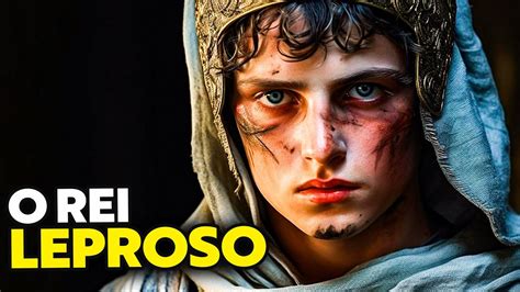 Rei Leproso De Jerusalém LIBRAIN