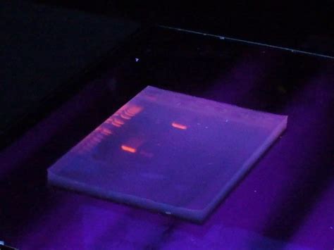 Serum Protein Electrophoresis And Their Clinical Importance Ppt