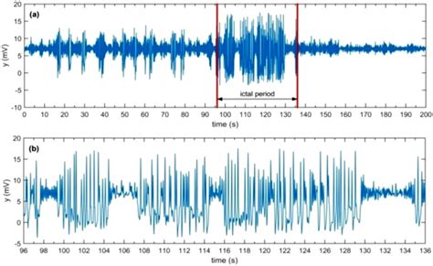 Output Of The Neural Mass Model When The Eeg Signal Is Used As The