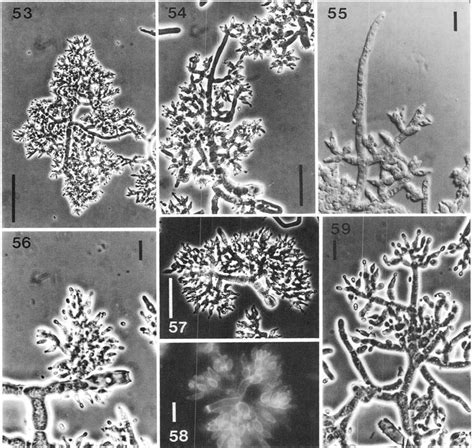 Hypocrea Capitata Trichoderma Anamorph From Cmd Figs 53 54 56 57