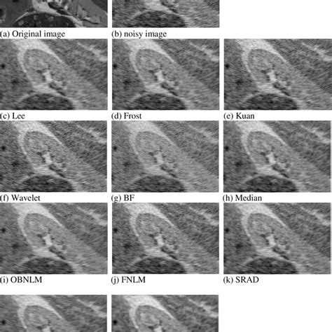 Denoising Comparison Of Simulation Diagram Download Scientific