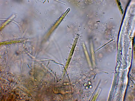 Una De Cianobacterias Y Algas Microscopía Foro De Micología