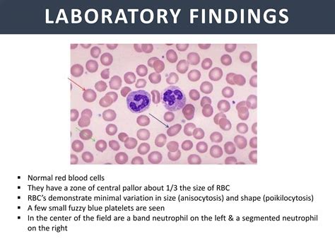 Management Of Thalassemia Pptx