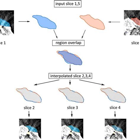 One Iteration In The Proposed Morphological Contour Interpolation