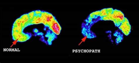 Psychopathic Brain Scans