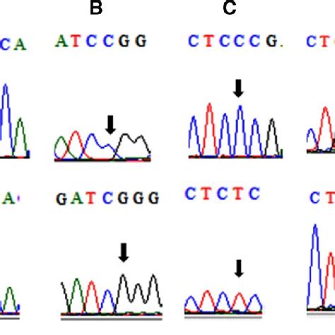 Dna Sequence Chromatograms Corresponding To Myc Common Variants Top Download Scientific